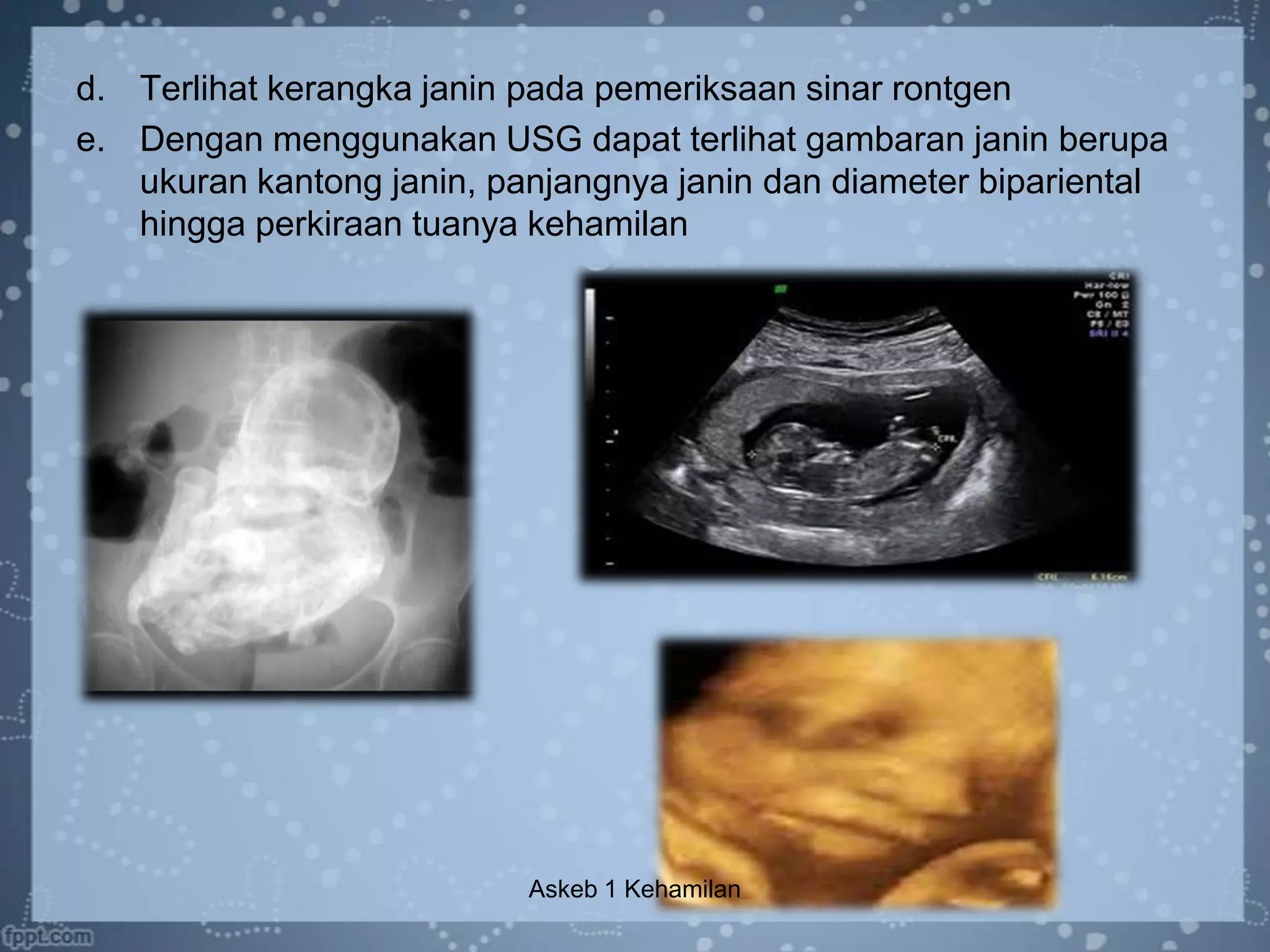 Tanda tanda kehamilan dan pemeriksaan diagnostik kehamilan | PDF