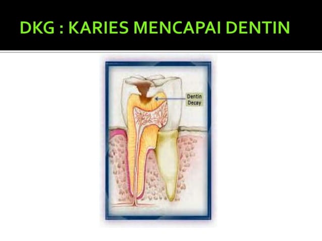 TANDA-TANDA KLINIS DIAGNOSIS KEPERAWATAN GIGI.pptx