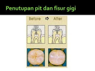 TANDA-TANDA KLINIS DIAGNOSIS KEPERAWATAN GIGI.pptx