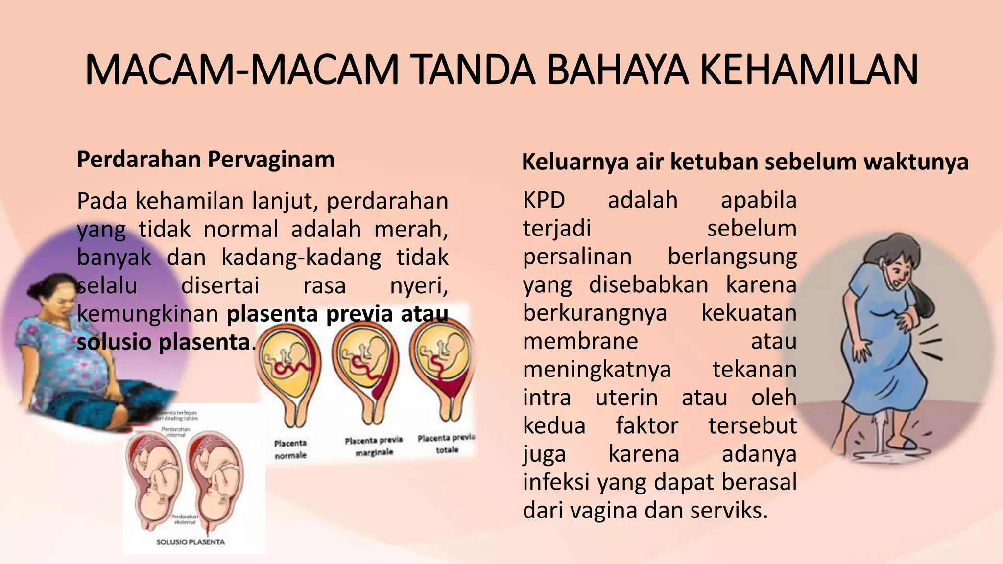 TANDA BAHAYA PADA KEHAMILAN.ppt