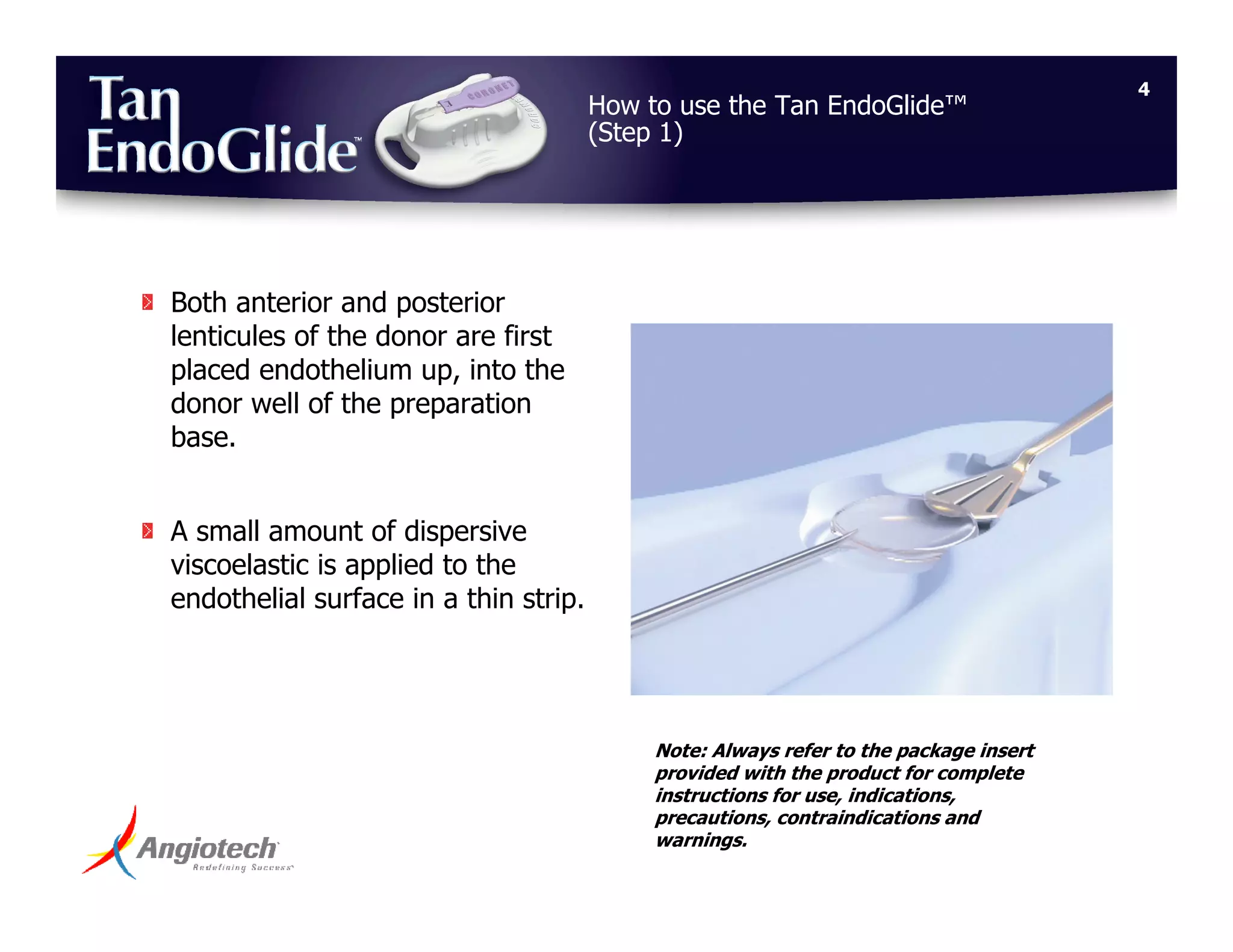 Tan endoglide for lamellar surgery, DSAEK | PDF