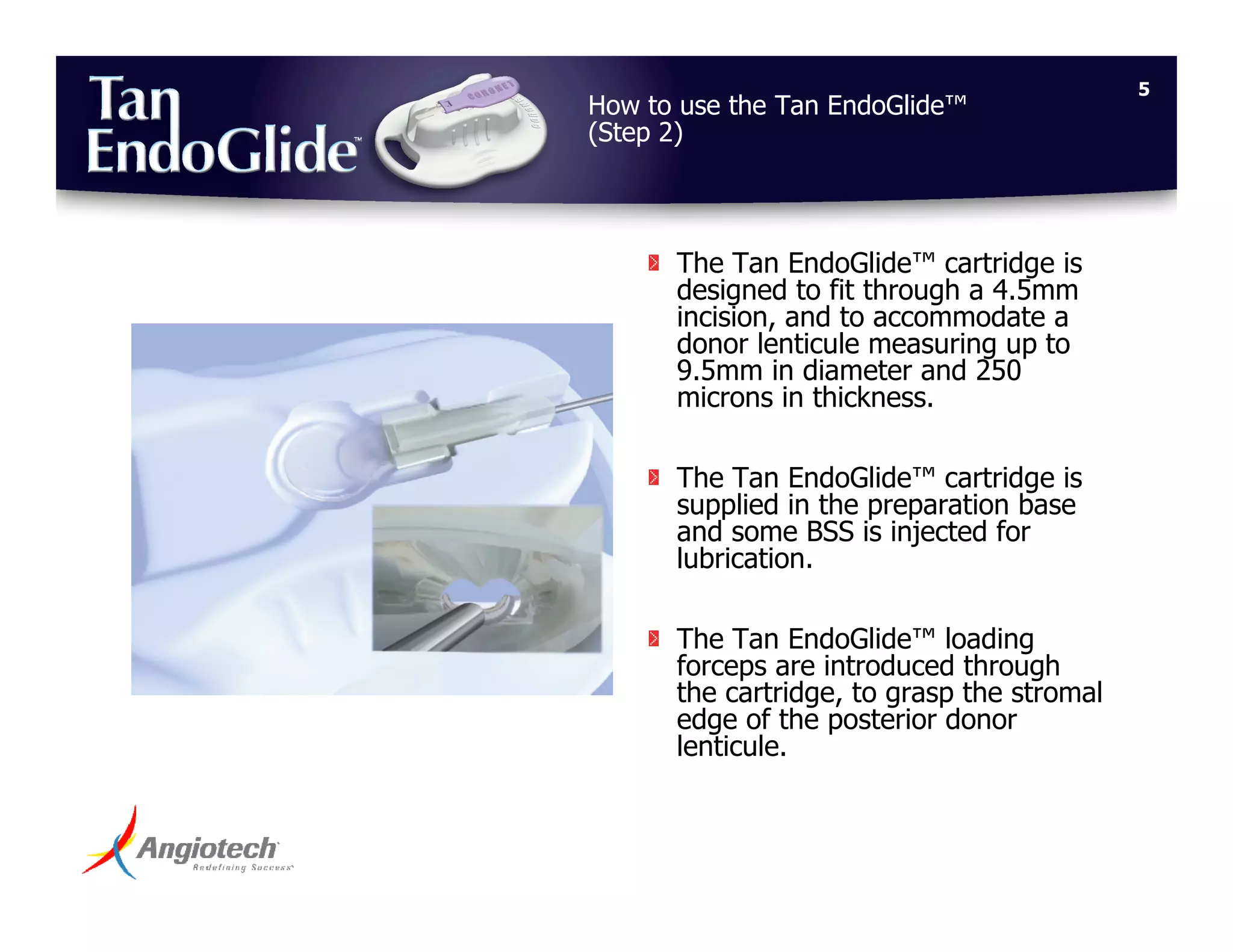 Tan endoglide for lamellar surgery, DSAEK | PDF