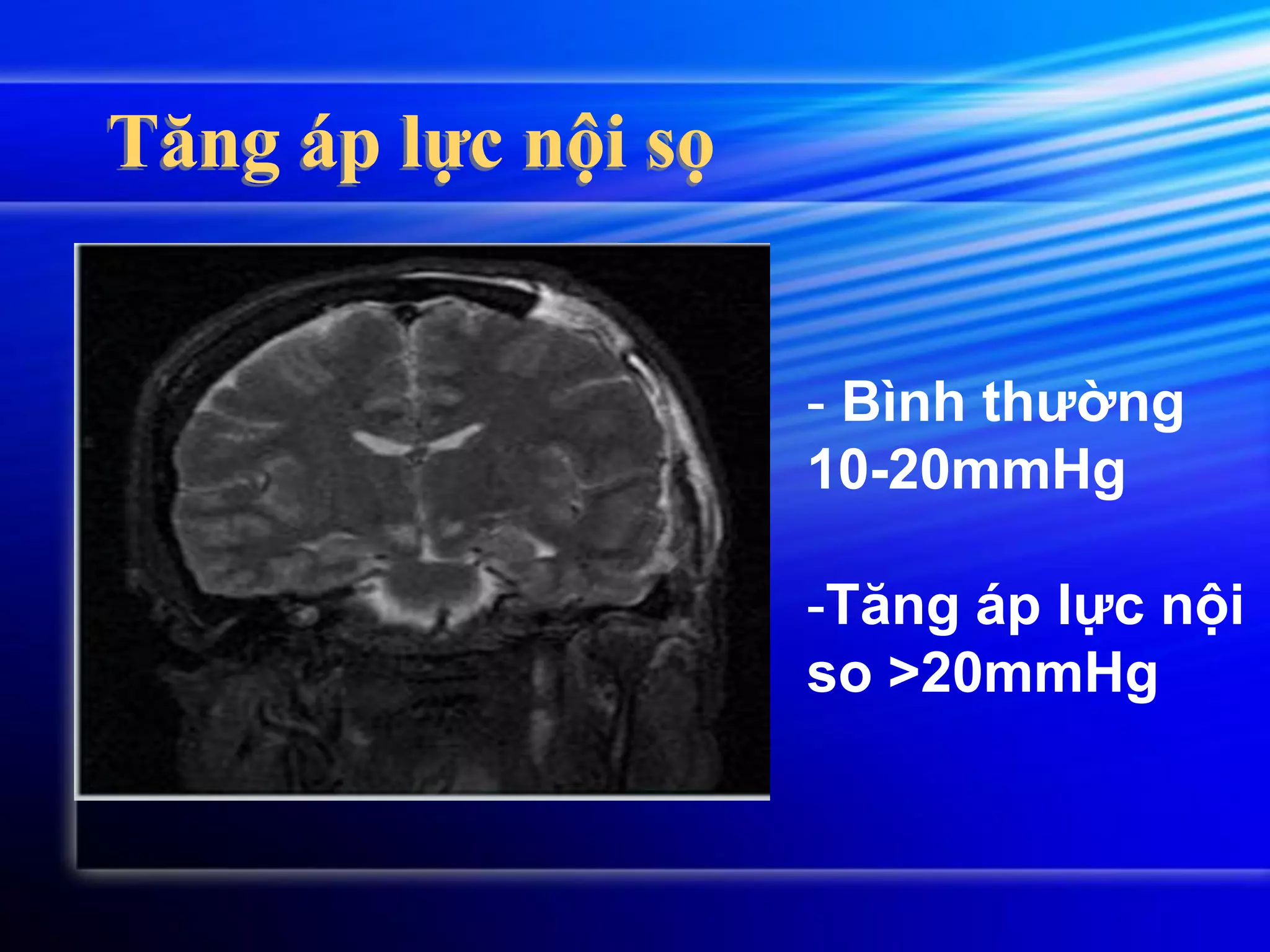 Tang ap luc noi so cao phi phong (2016) | PDF