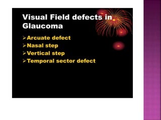 Tangent screen | PPTX