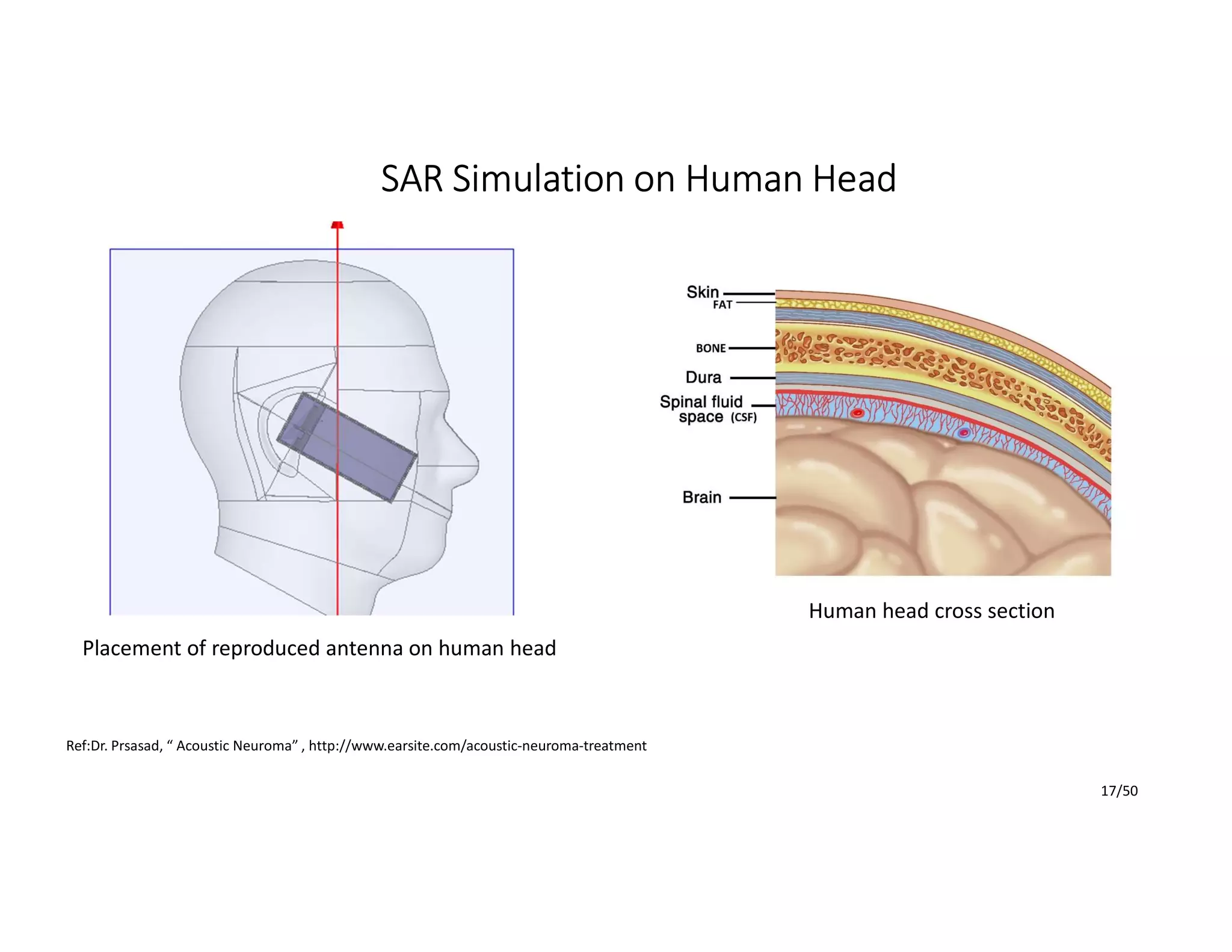 ANALYSIS OF BIOLOGICAL EFFECTS OF CELL PHONE RADIATION ON HUMAN BODY ...