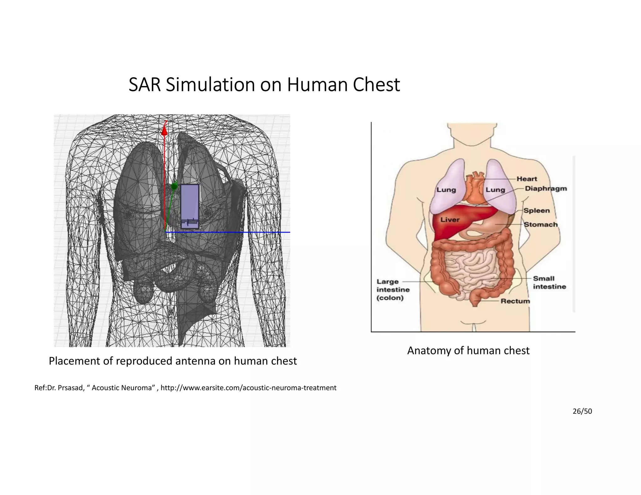 ANALYSIS OF BIOLOGICAL EFFECTS OF CELL PHONE RADIATION ON HUMAN BODY ...