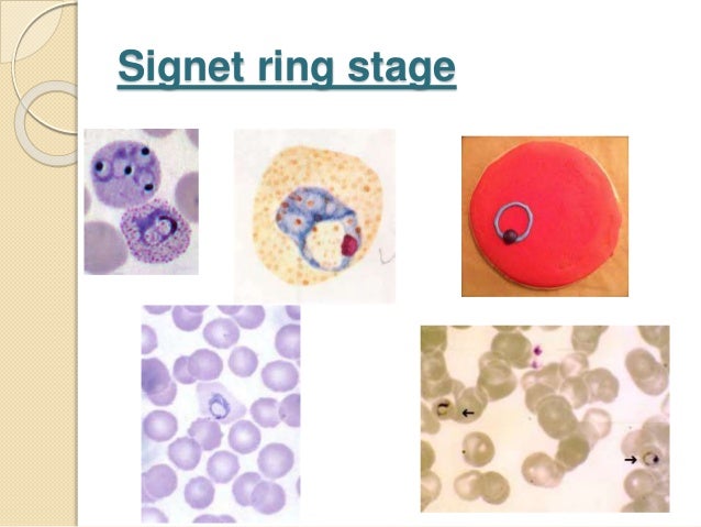 Plasmodium Life Cycle