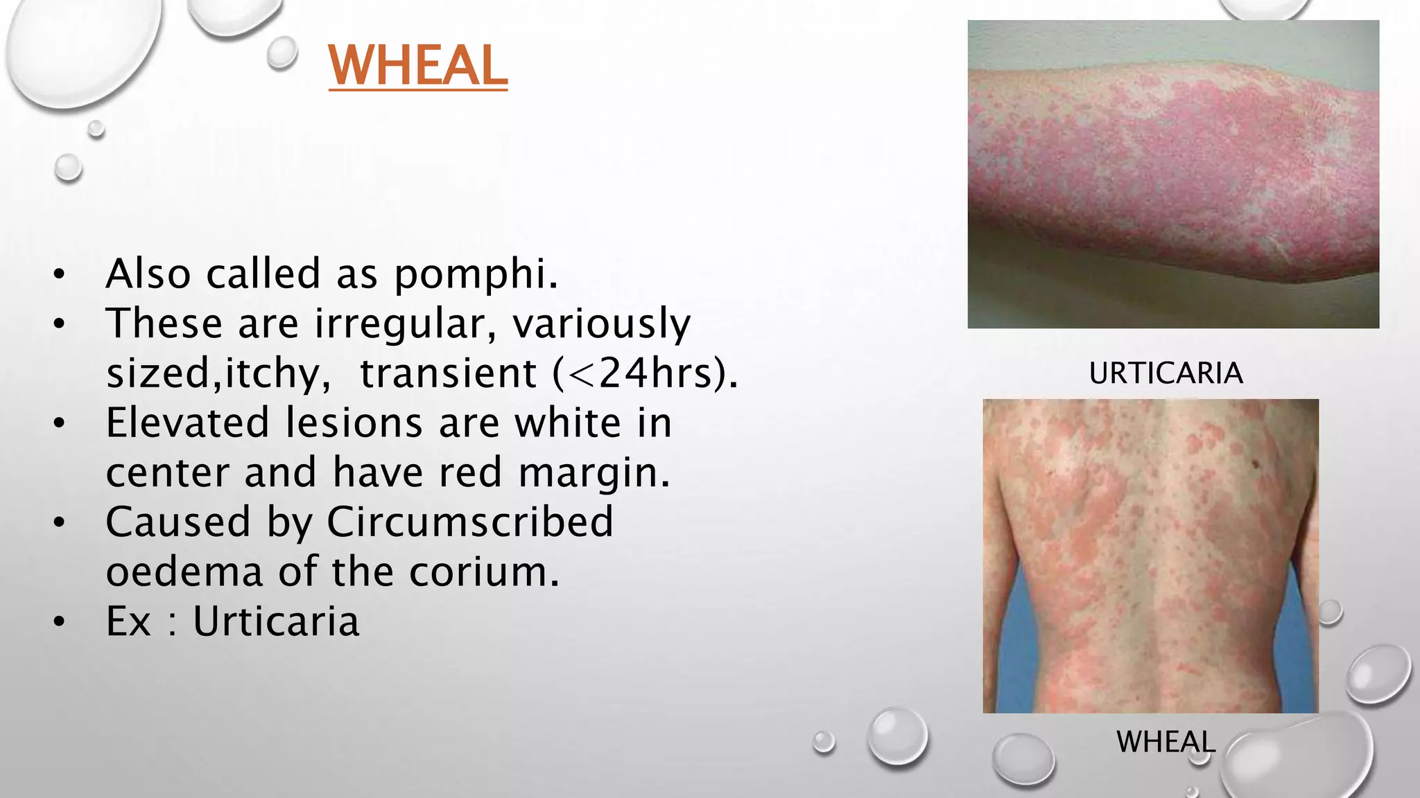 Primary skin lesions | PPTX
