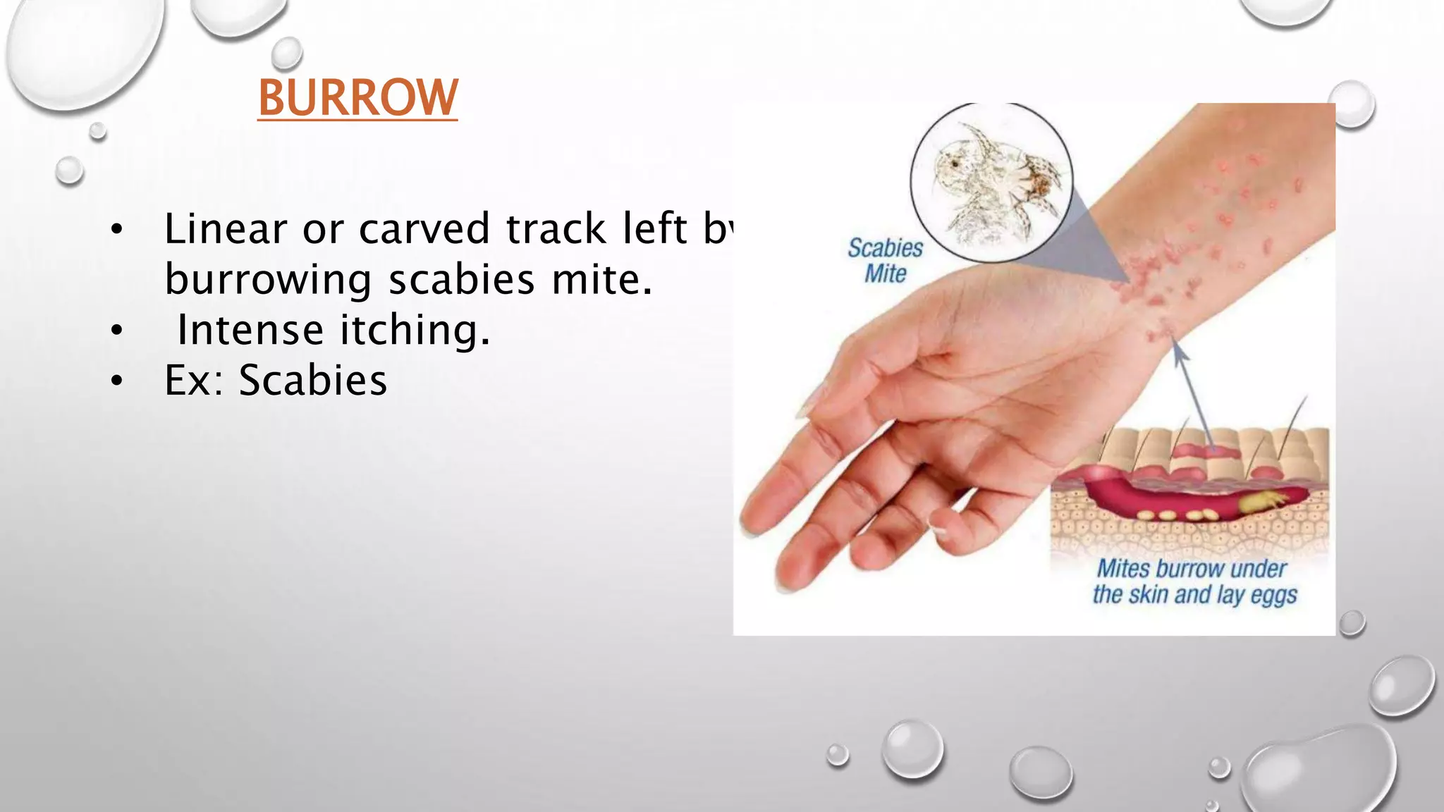 Primary skin lesions | PPTX