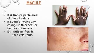 Primary skin lesions | PPTX | Skin and Dermatology | Diseases and ...