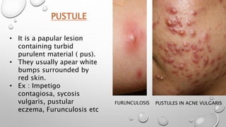 Primary skin lesions | PPTX