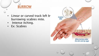 Primary skin lesions | PPTX