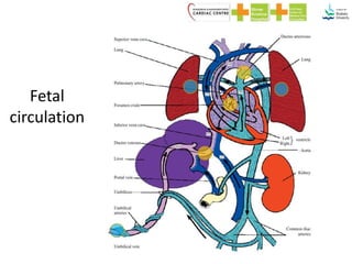 critical congenital heart disease | PPTX