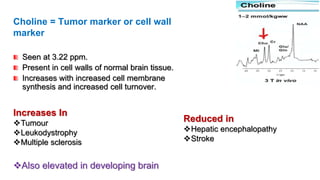 Basic physics and normal interpretation of MRS | PPTX