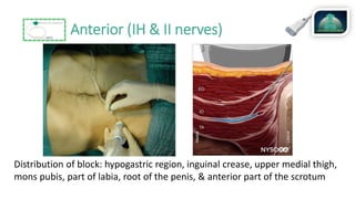 Ultrasound-Guided Transversus Abdominis Plane Blocks | PPT