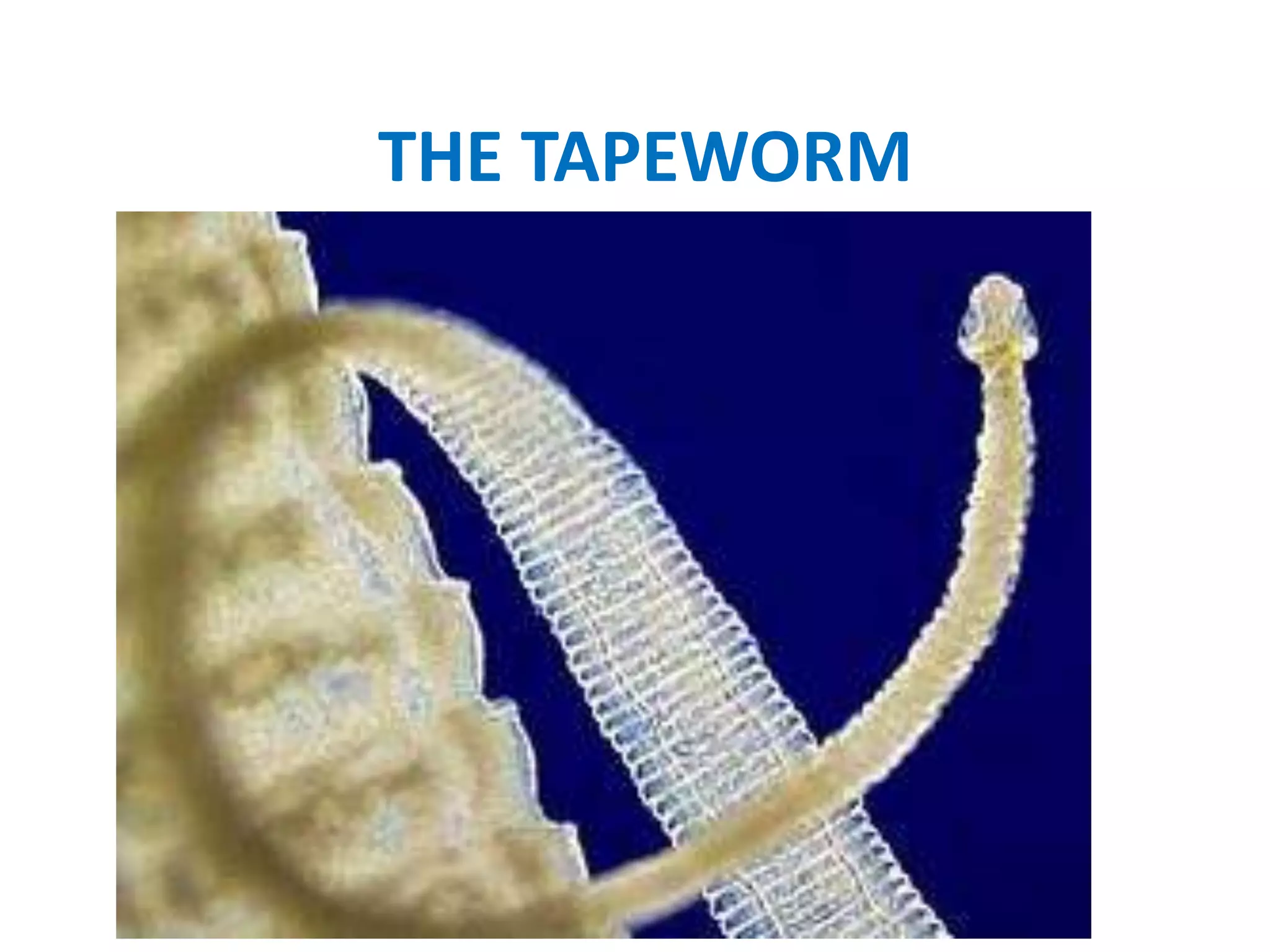 Tapeworm | PPTX