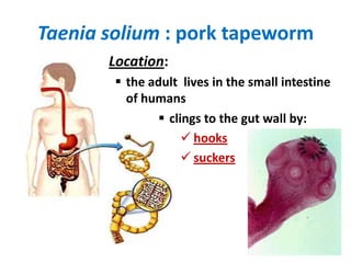 Parts Of A Tapeworm
