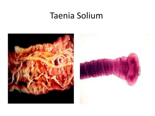 Tapeworms | PPTX