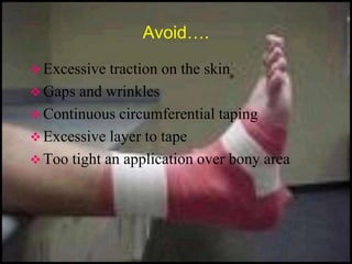 taping.ppt kinesiology, biomechanics, ortho | PPT