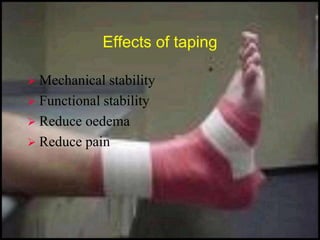 taping.ppt kinesiology, biomechanics, ortho | PPT