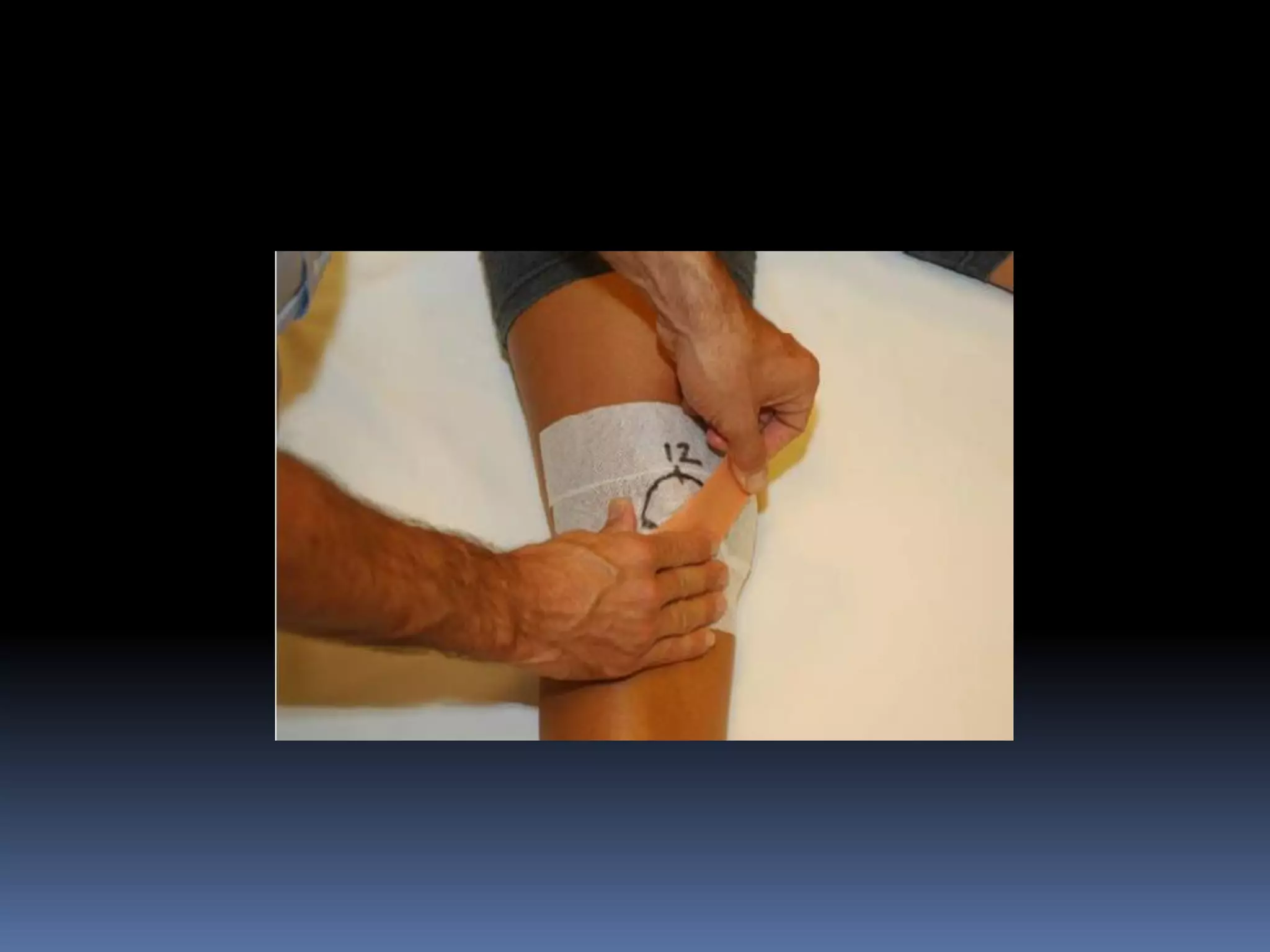 Taping for patellofemoral pain syndrome | PDF