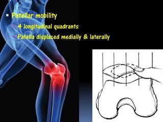 Taping for patellofemoral pain syndrome | PDF