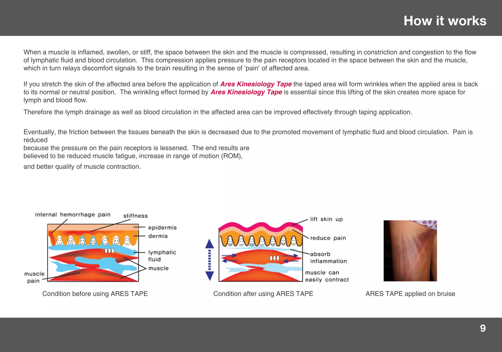 Taping Guide | PDF