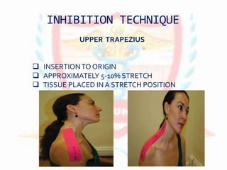 kinesioTaping | PPTX