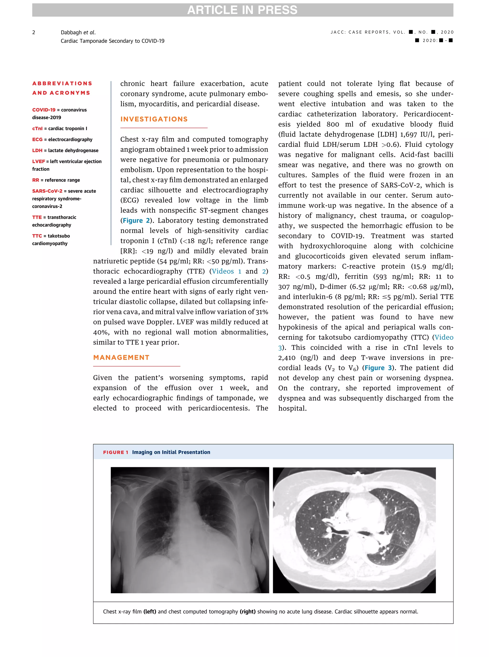 Taponamiento cardica covid | PDF