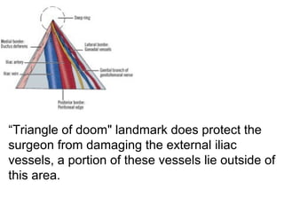 Triangle Of Doom And Pain