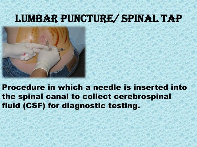 Tapping methodology in modern and ayurvedic therapy | PPT