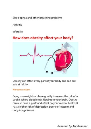 All about Overweight and Obesity. | PDF