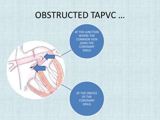 TAPVC A CASE STUDY | PPTX