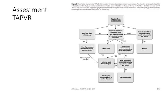 TAPVD ASD slide presentation echo pediatri.pptx