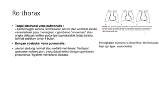 TAPVD ASD slide presentation echo pediatri.pptx