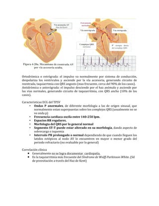 Taquiarritmias | PDF