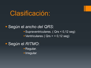 Taquiarritmias qrs angosto | PPTX
