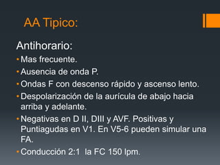 Taquiarritmias qrs angosto | PPTX