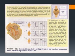 Taquiarritmias qrs angosto | PPTX