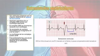 TAQUIARRITMIAS VENTRICULARES.pptx
