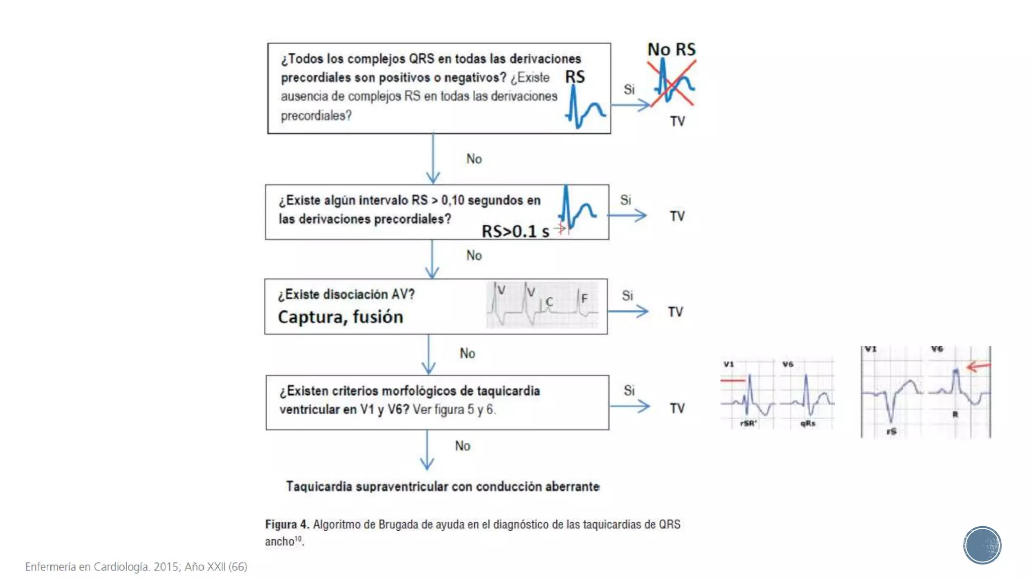 Taquicardia de complejo QRS ancho 2021.pptx