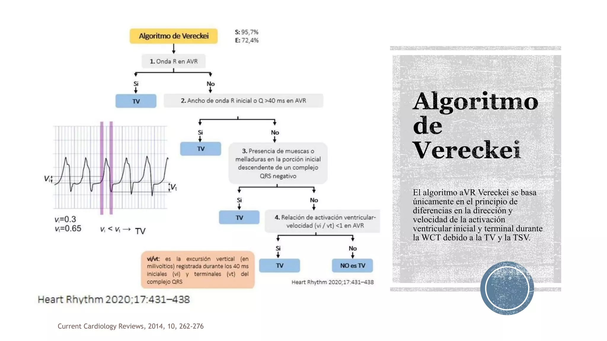 Taquicardia de complejo QRS ancho 2021.pptx