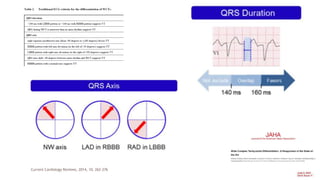 Taquicardia de complejo QRS ancho 2021.pptx