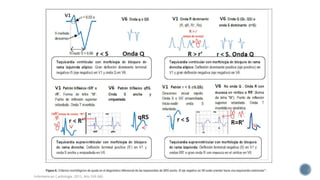 Taquicardia de complejo QRS ancho 2021.pptx