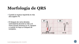 Taquicardia de complejo QRS ancho 2021.pptx