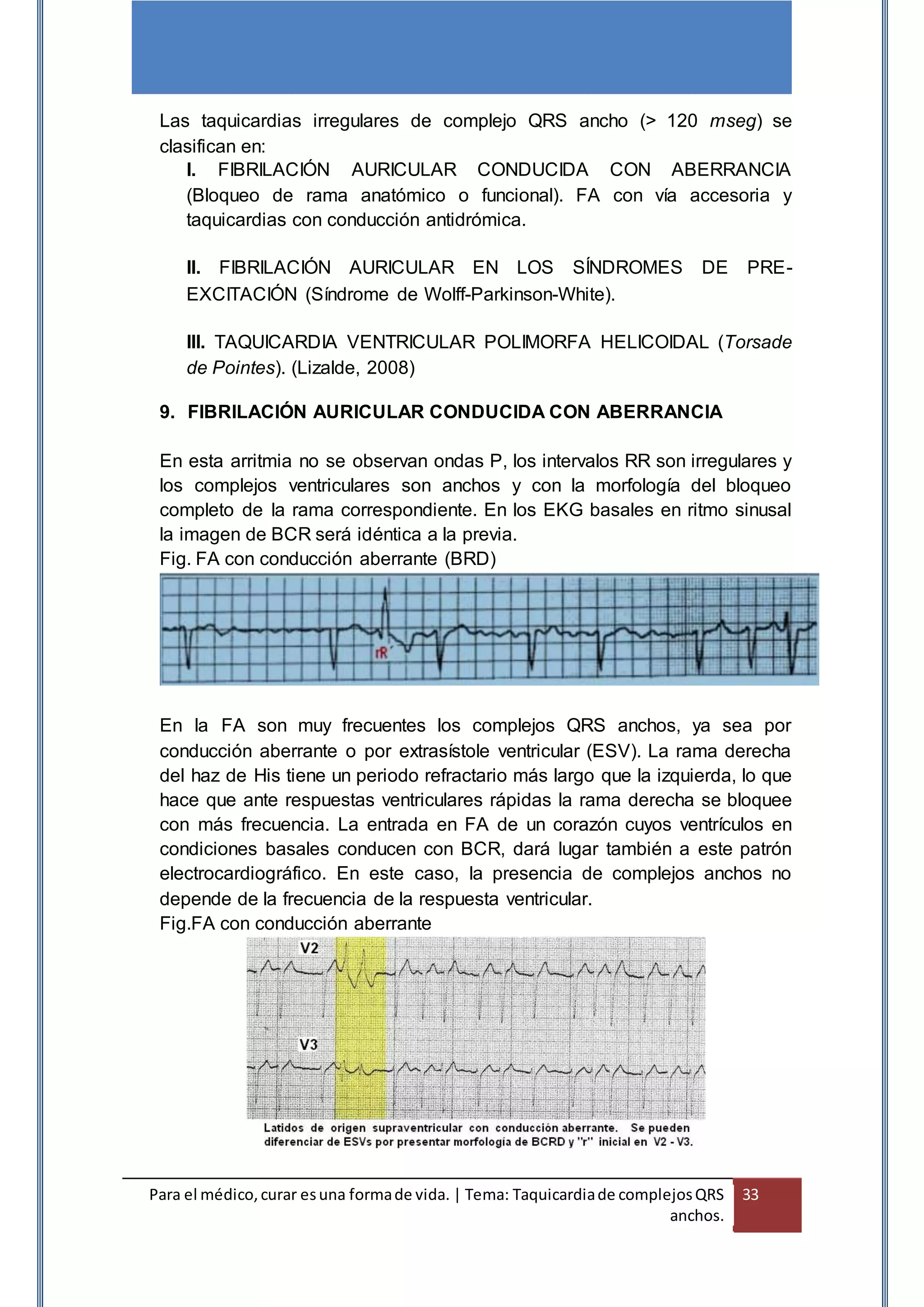 Taquicardia de complejos qrs anchos | DOCX