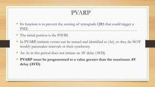 Taquicardia por marcapasos. pptx.pptx