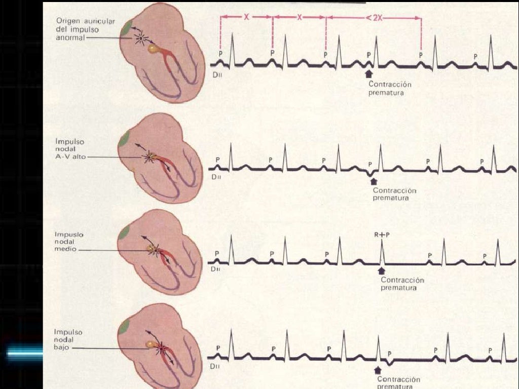 Taquicardias UAT Cardiologia Maestria Urgencias