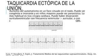 Taquicardias superventriculares y ventriculares | PPT