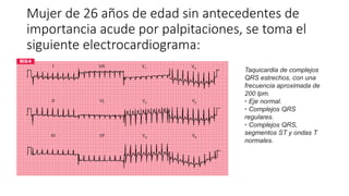 TAQUICARDIA SUPRAVENTRICULAR.pptx